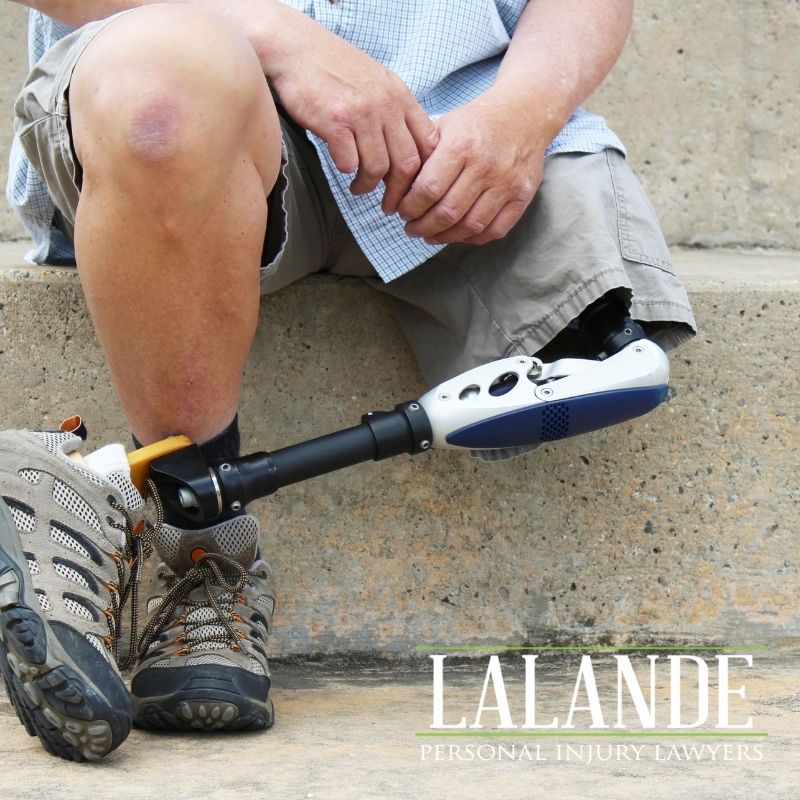 Traumatic Amputation Injuries and Psychological Distress